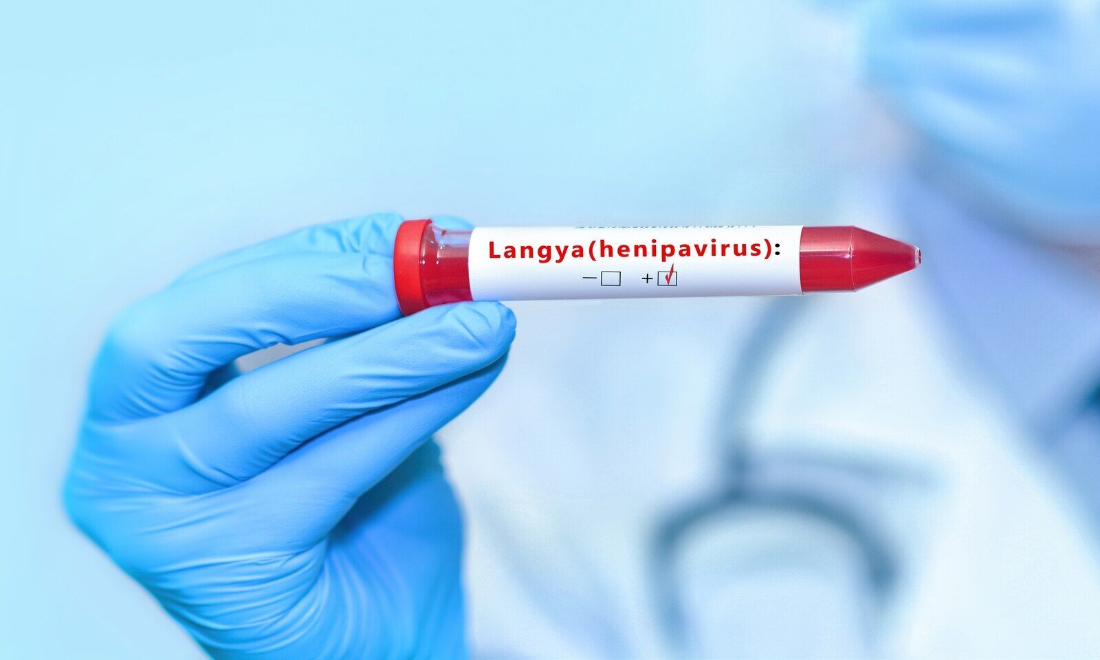 Langya Virus: What We Know So Far About the New Virus Found in China